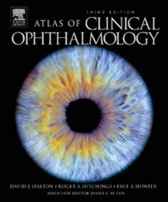 Atlas Of Clinical Ophthalmology With Cd-Rom - Merlin Library - Online ...